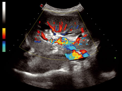 MyLab ™ Seven - Böbrek Vaskülarizasyonu - Turkey