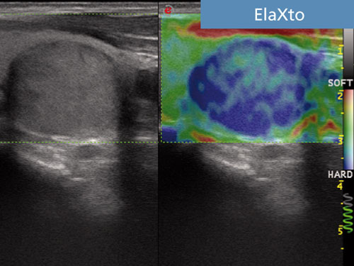 MyLab ™ Seven - ElaXto Görüntüleme - Turkey