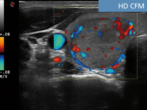 MyLab ™ Seven - HD CFM Görüntüleme - Turkey